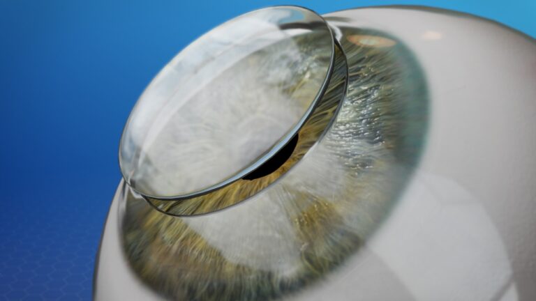 The Process and Benefits of Cornea Transplant Surgery - Hi Boox